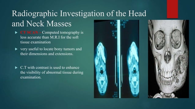 Neck mass differential diagnosis | PPTX | Thyroid Disorders | Endocrine ...