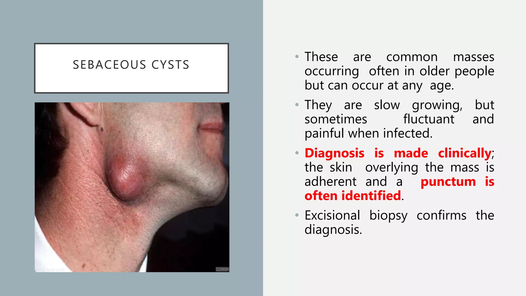 Neck masses | PPTX