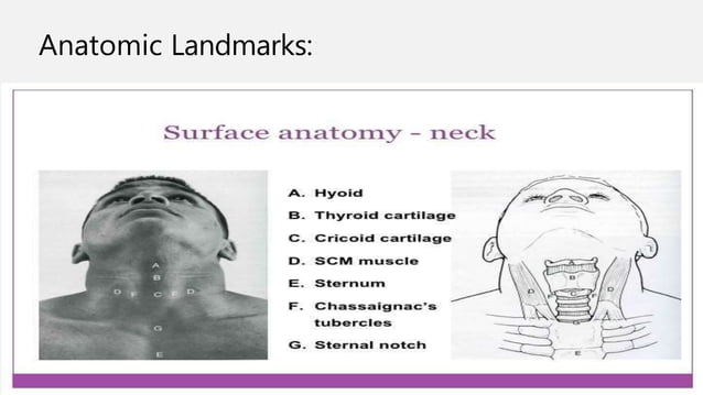Neck masses | PPTX | Ear, Nose and Throat Conditions | Diseases and ...