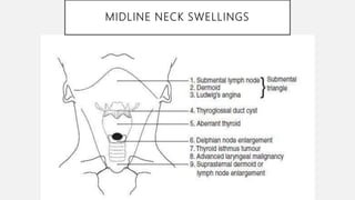 Neck masses | PPTX