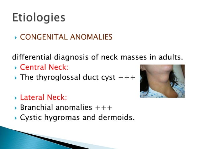 Neck masses in adult | PPT