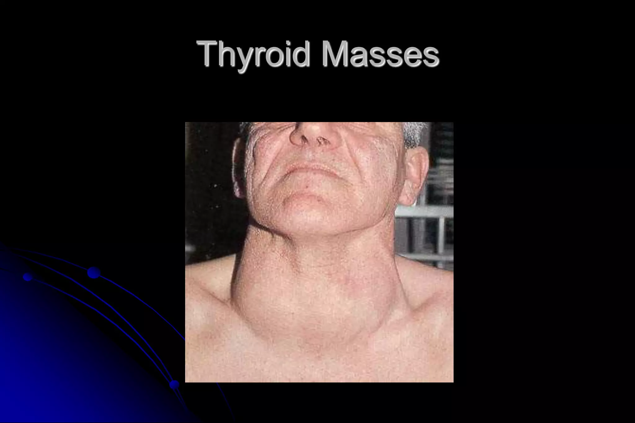 Neck mass | PPTX