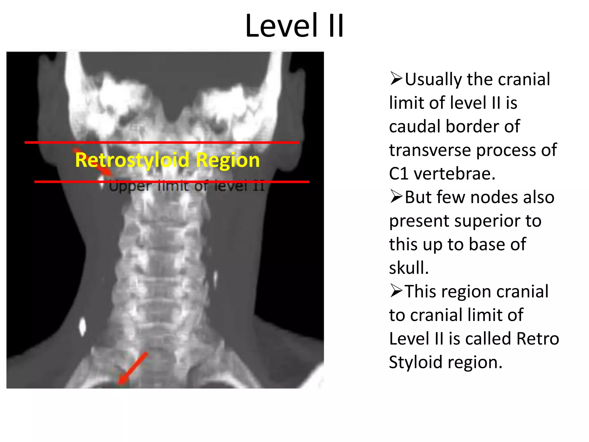 Neck node & Contouring Guidelines | PPTX