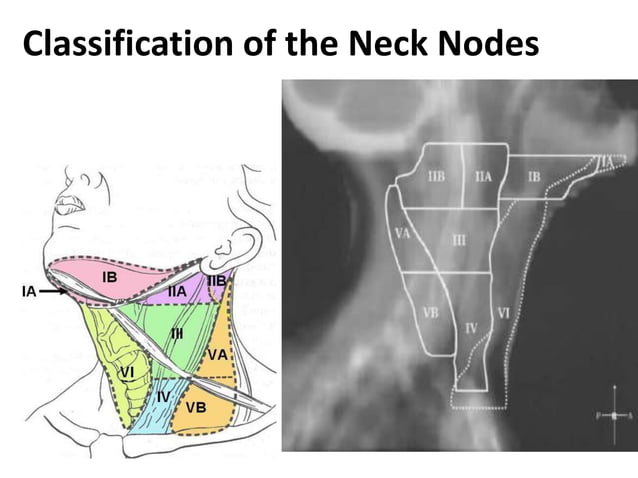 Neck node & Contouring Guidelines | PPTX