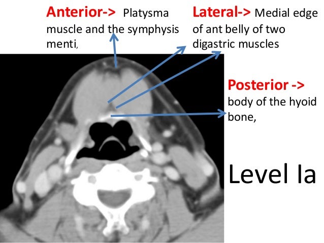 Neck node & Contouring Guidelines