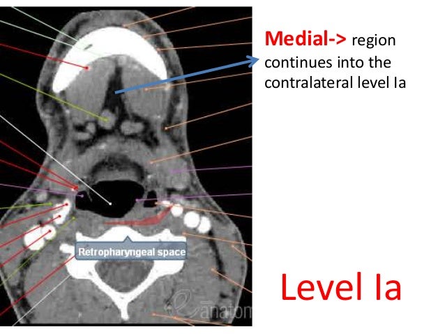 Neck node & Contouring Guidelines