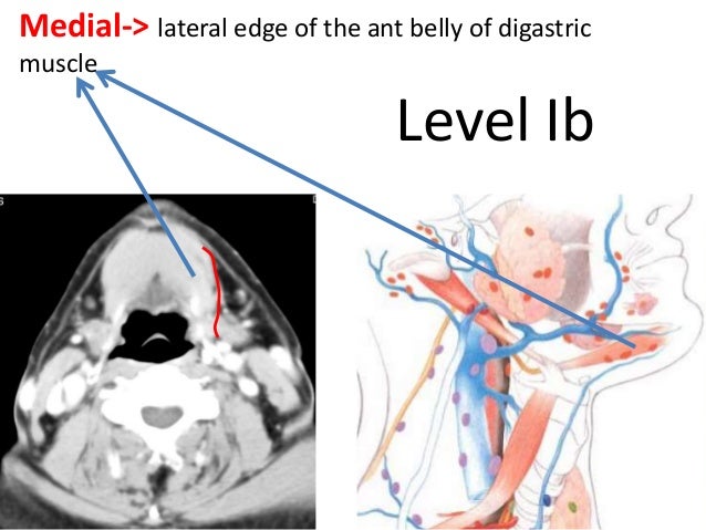 Neck node & Contouring Guidelines