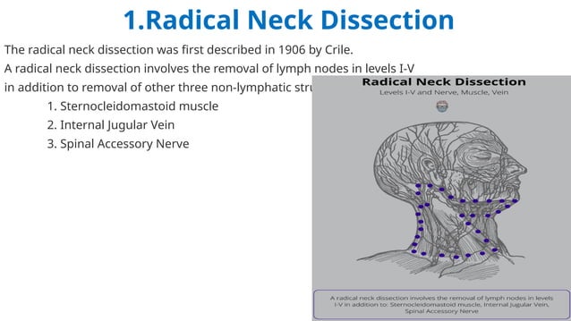 neck nodes and dissection types and lymph nodes levels | PPTX