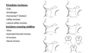 neck nodes and dissection types and lymph nodes levels | PPTX