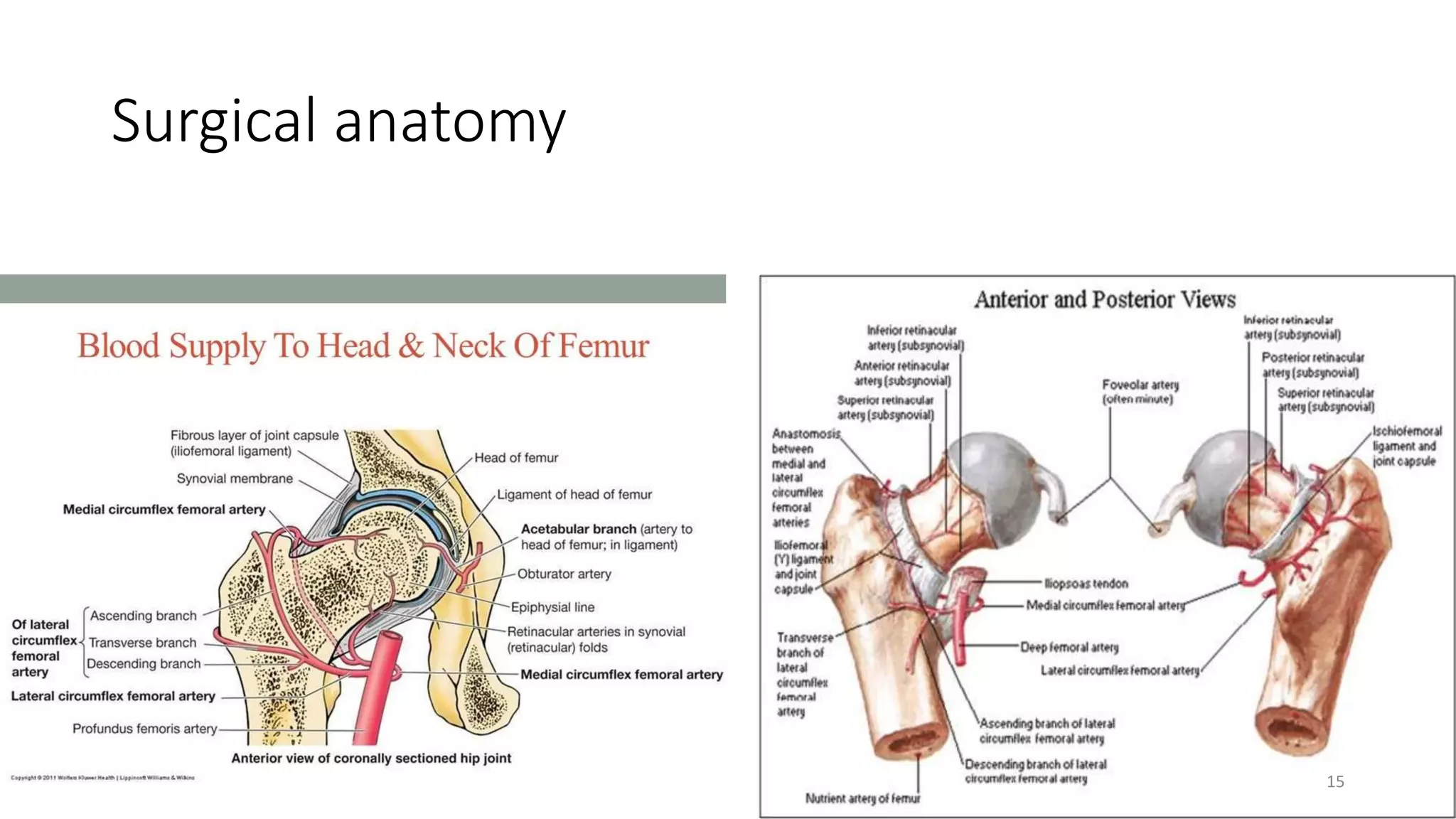 management of neck of femur fracture | PPTX