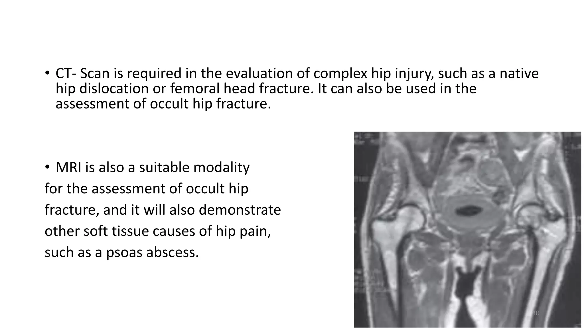 management of neck of femur fracture | PPTX