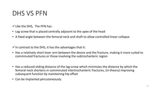 management of neck of femur fracture | PPTX
