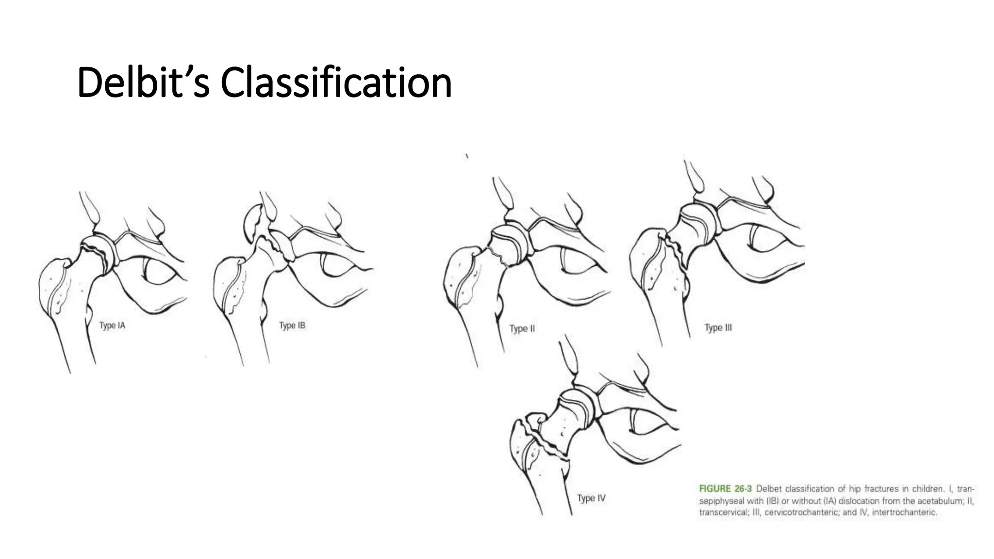 NECK OF FEMUR FRACTURE ORTHOPAEDICS.pptx