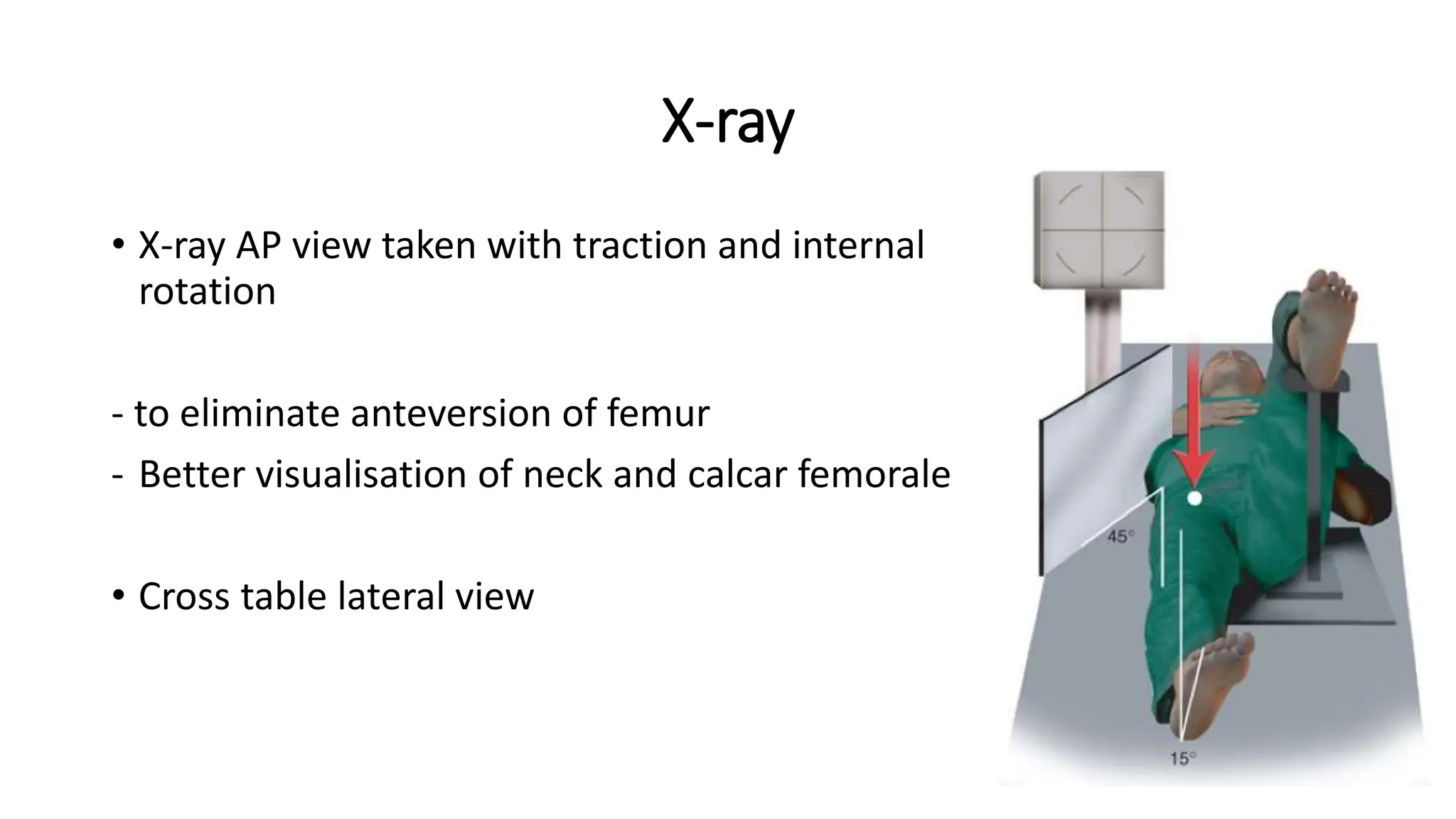 NECK OF FEMUR FRACTURE ORTHOPAEDICS.pptx