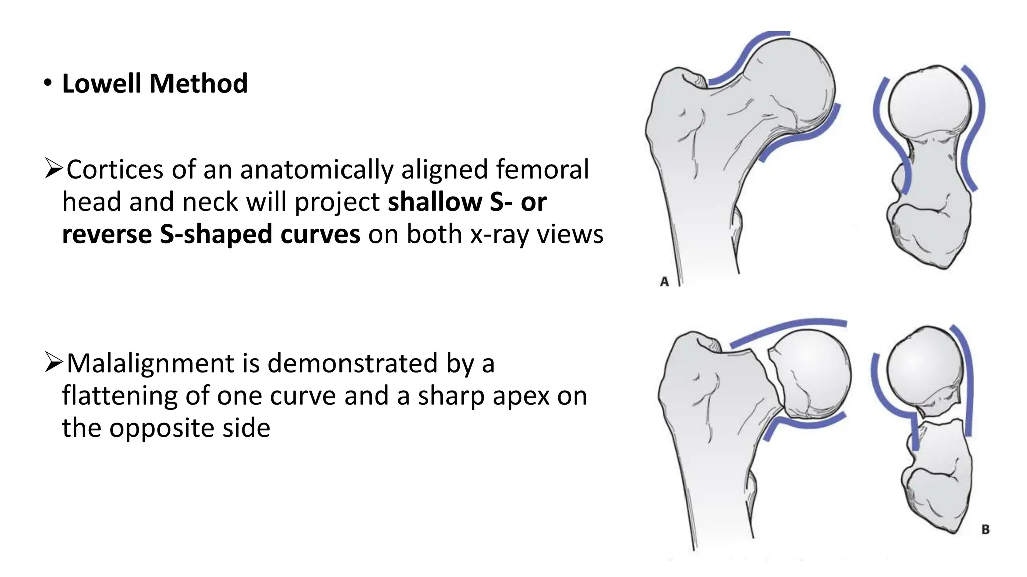 NECK OF FEMUR FRACTURE ORTHOPAEDICS.pptx