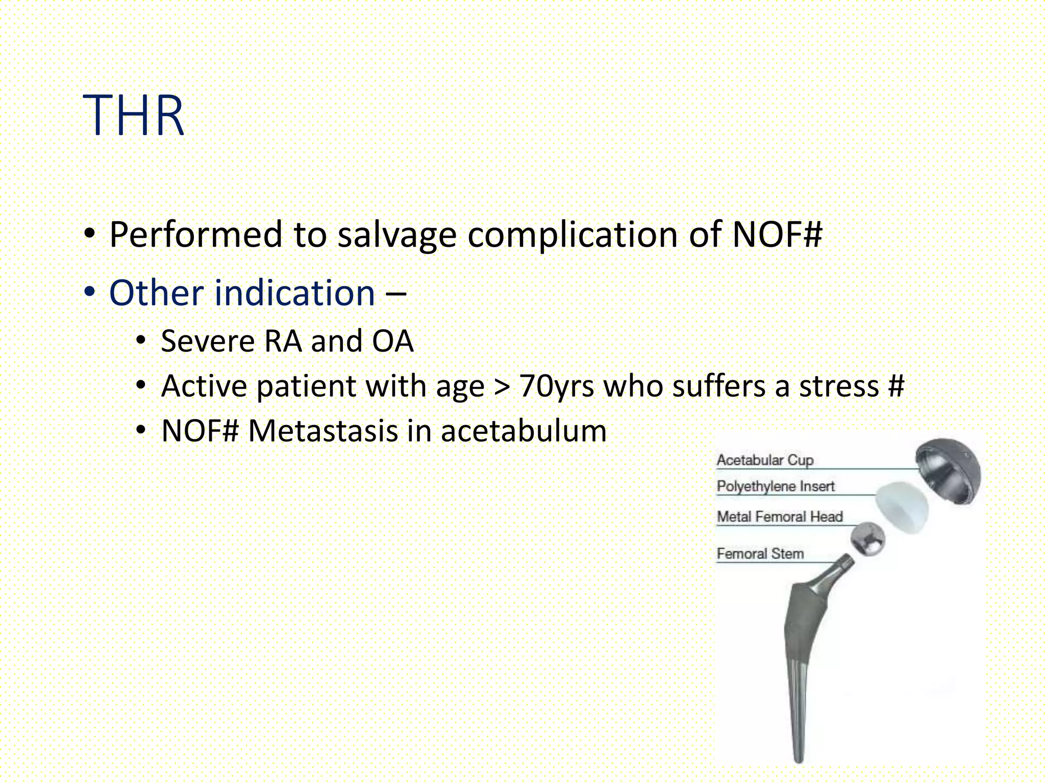 Neck of femur fracture & Trochanteric femur fracture | PPTX