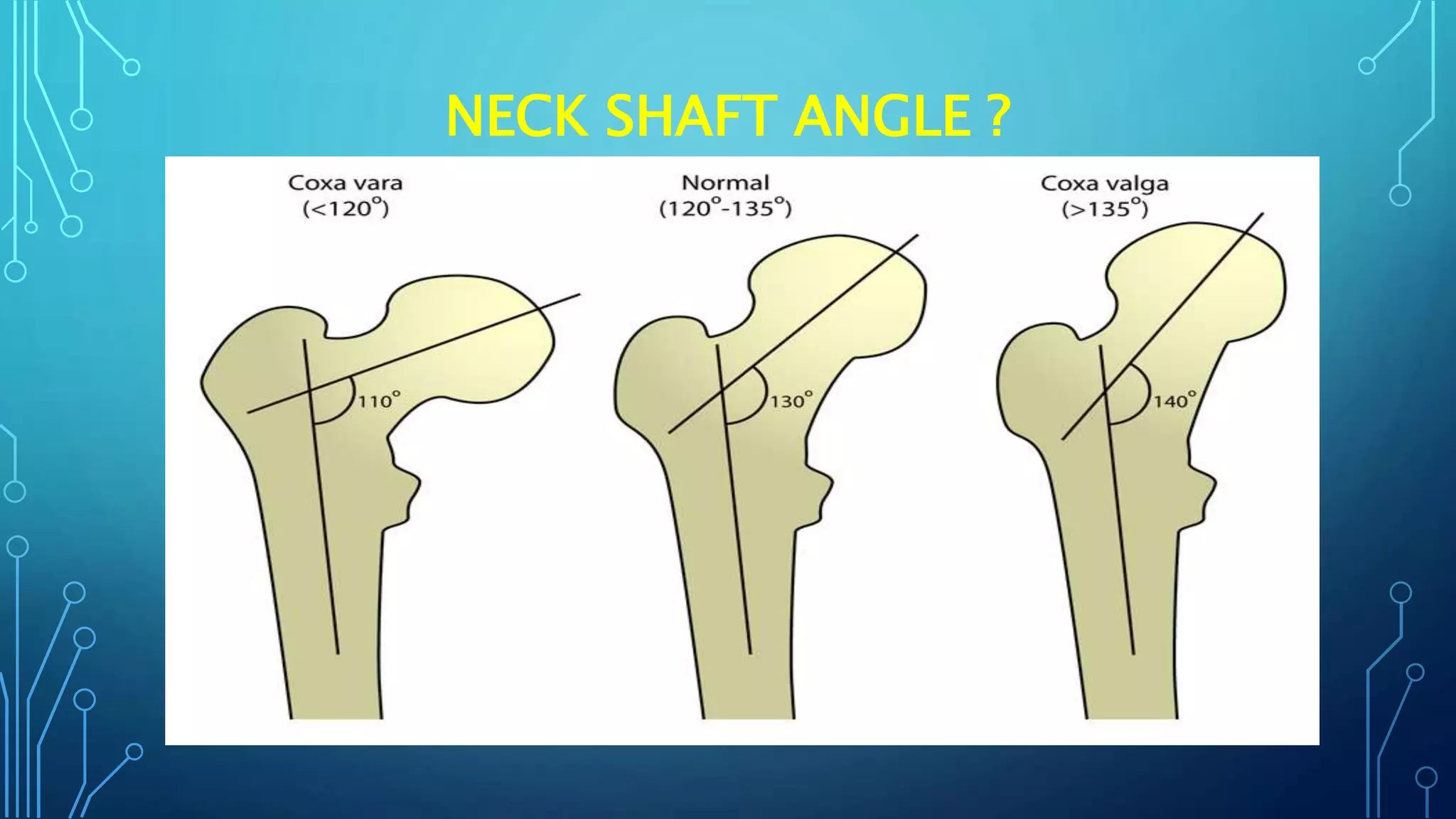 Neck of femur fracture | PPTX