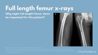 Neck of Femur Fractures PowerPoint (OnTheWard.com) | PDF