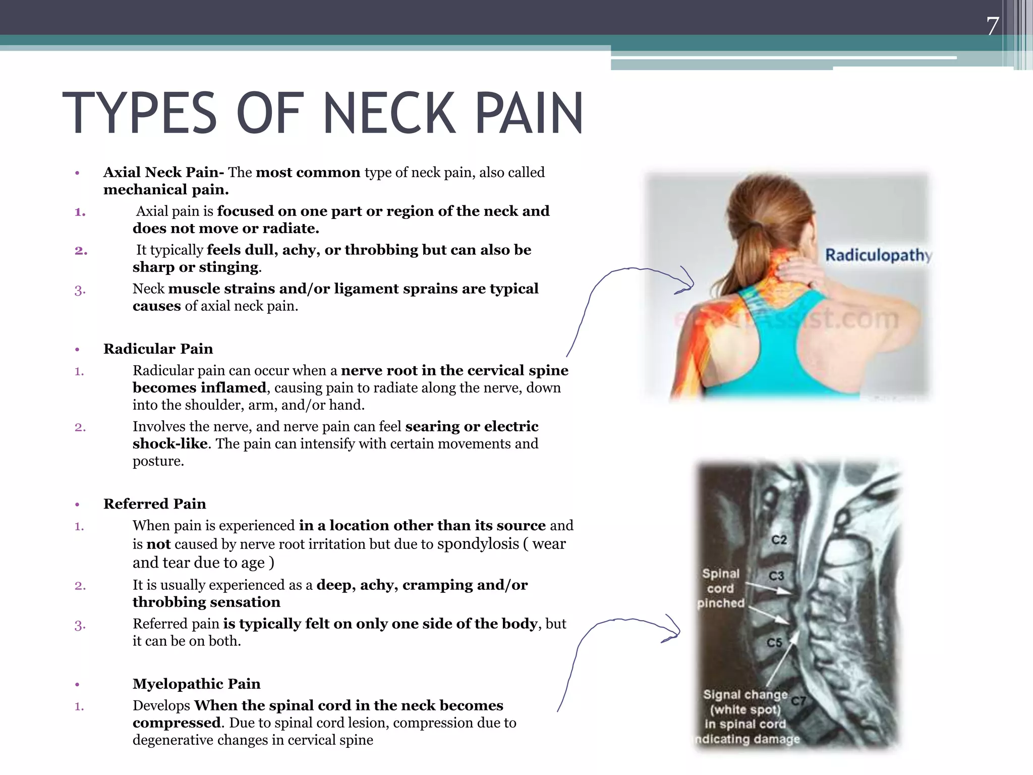 Neck pain- cause, tests, risk factors, treatment | PPTX