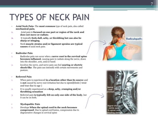 Neck pain- cause, tests, risk factors, treatment | PPTX
