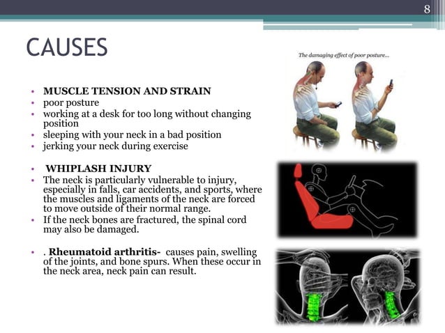 Neck pain- cause, tests, risk factors, treatment | PPT