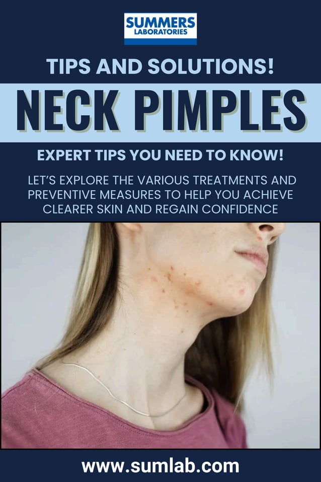 What home remedies can help reduce neck pimples? | PDF