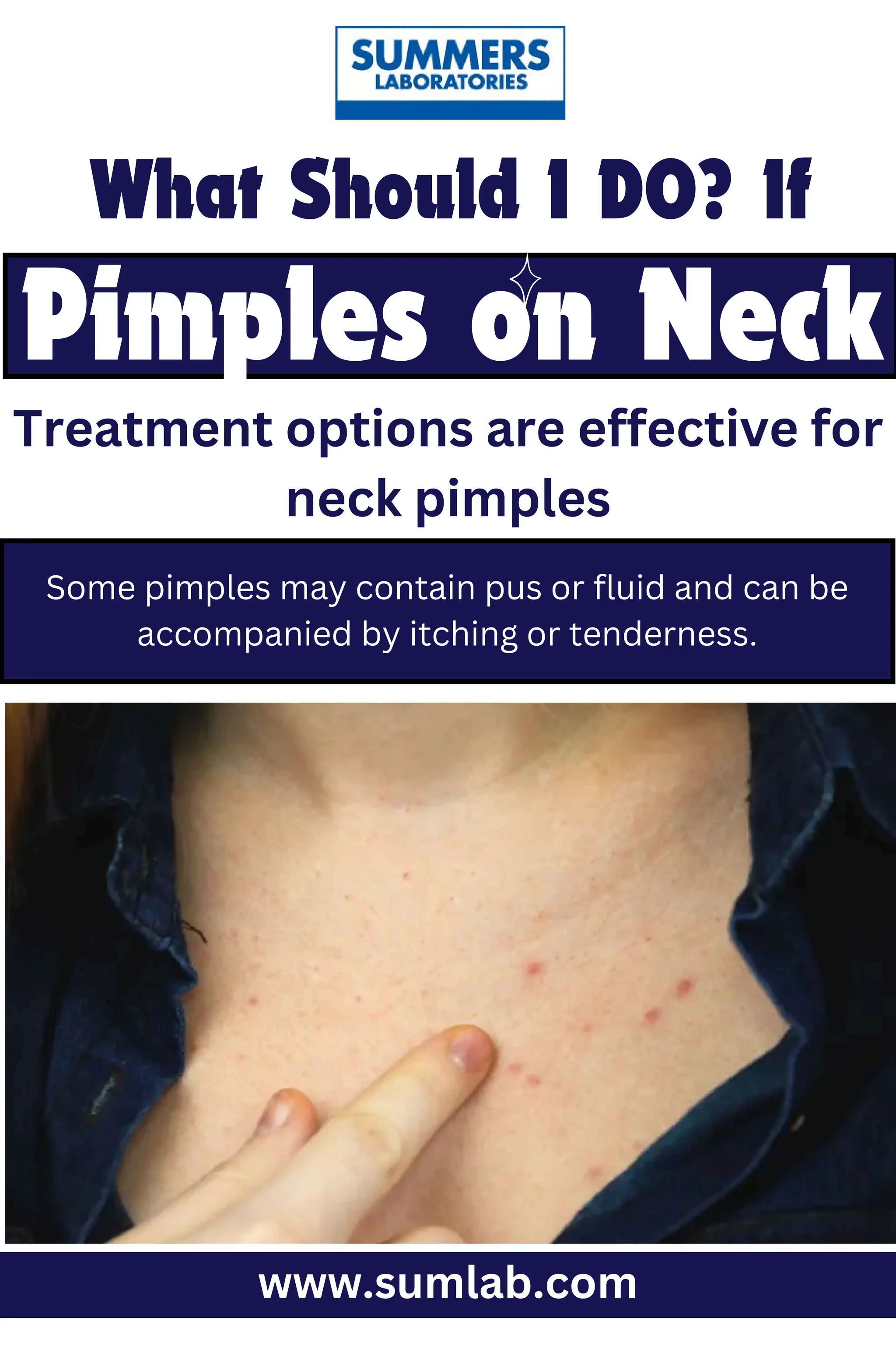 What symptoms should I look for to identify if I have neck pimples? | PDF