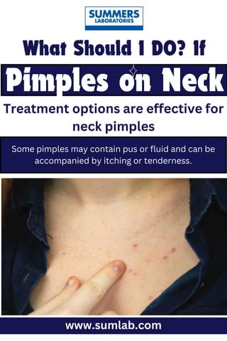 What symptoms should I look for to identify if I have neck pimples? | PDF