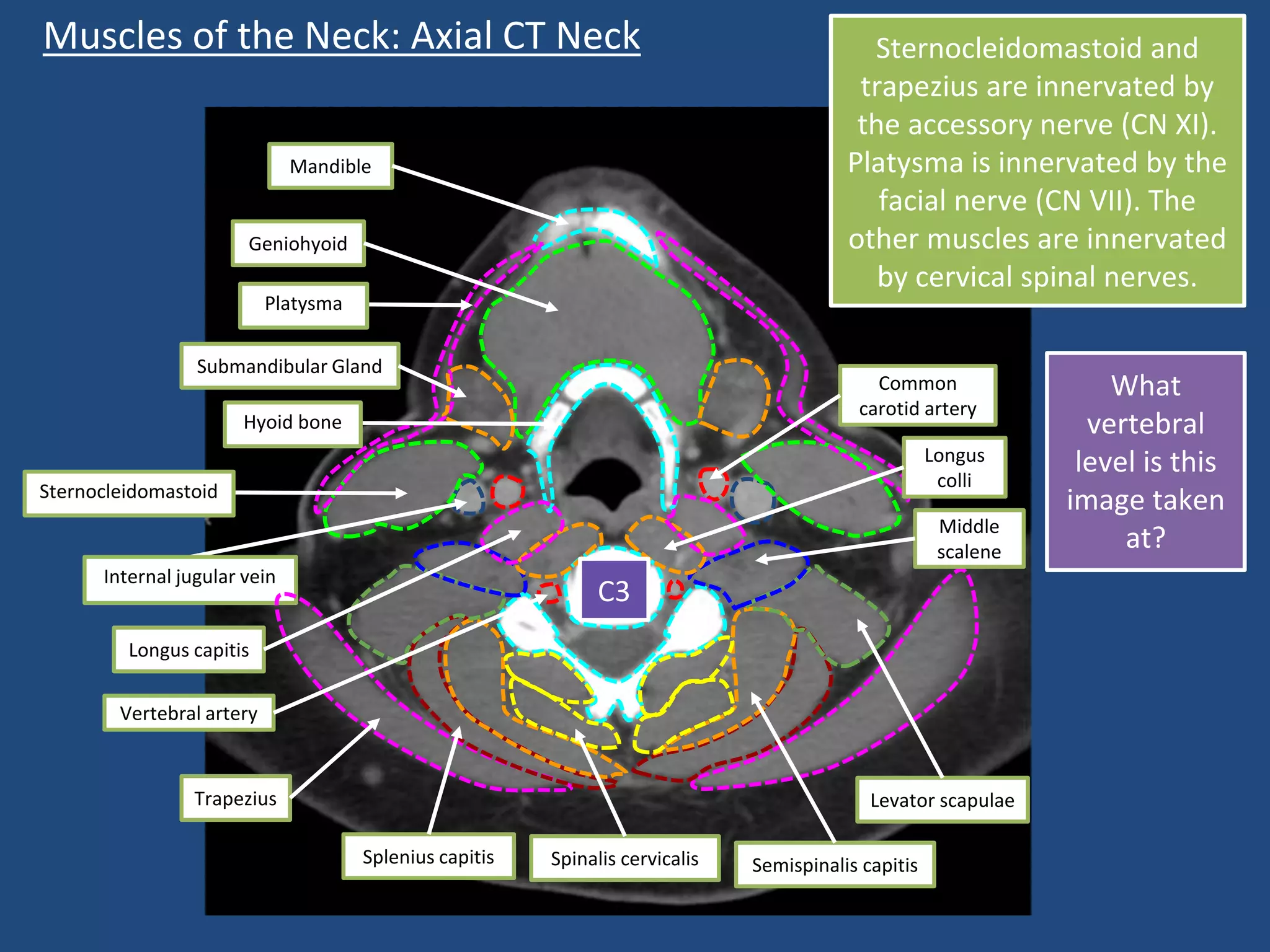 neck ppt.pptx
