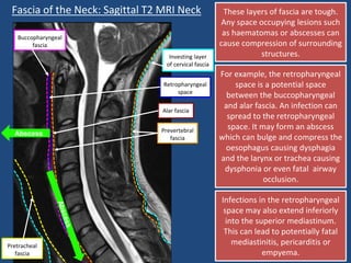 neck ppt.pptx