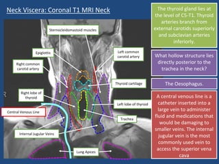 neck ppt.pptx