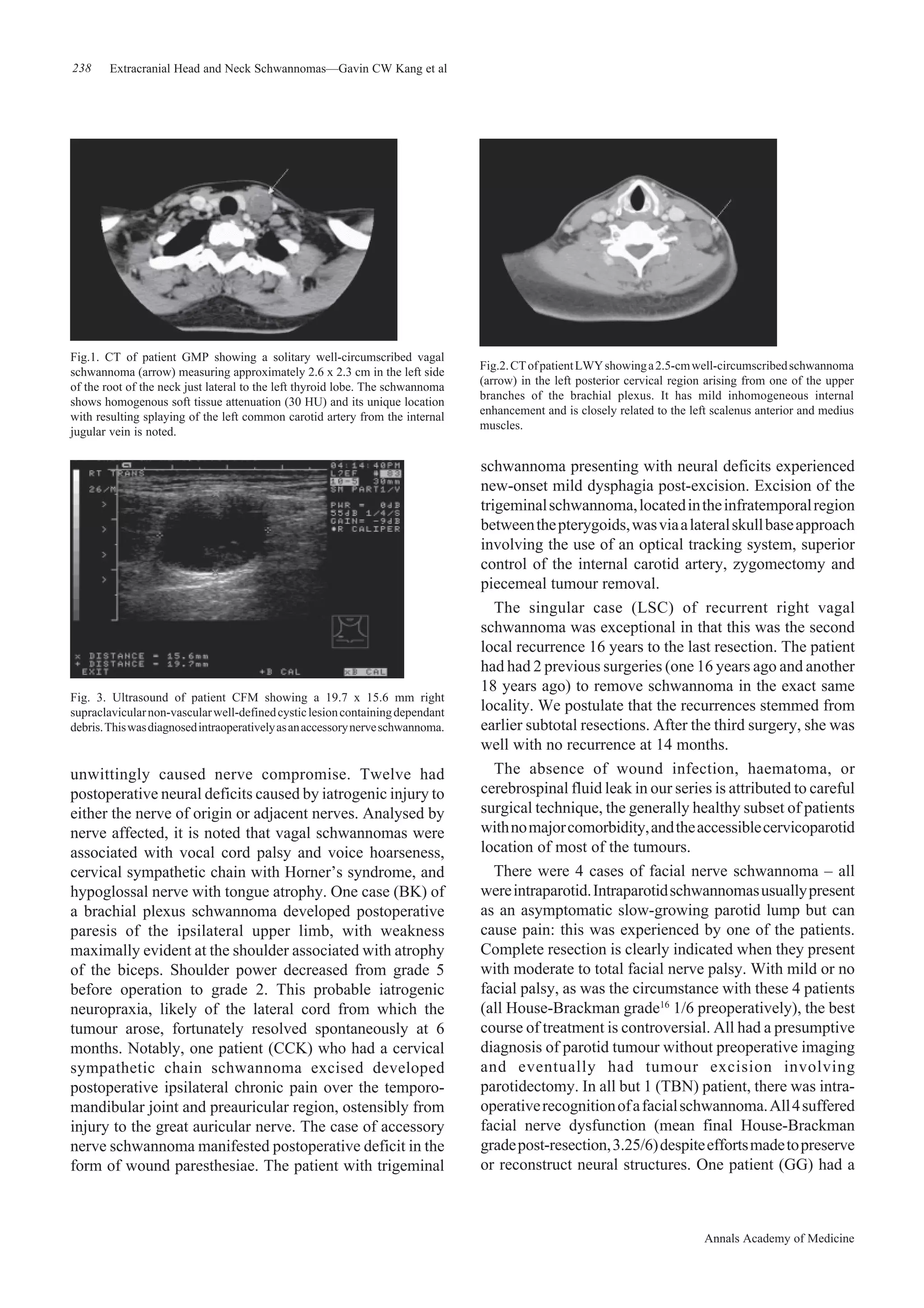 Neck schwannomas a ten year experience | PDF