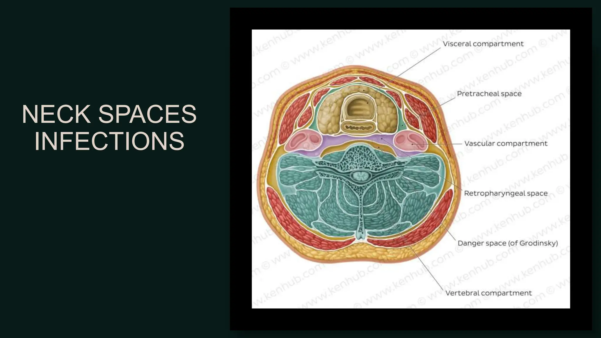 Neck space infections taken from PL. DHINGRA and other sources to cover all of the neck space ...