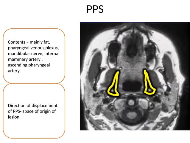 Radiological Anatomy of Neck Spaces with their clinical significance | PPTX