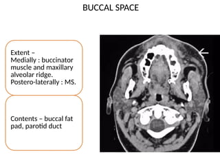 Radiological Anatomy of Neck Spaces with their clinical significance | PPTX