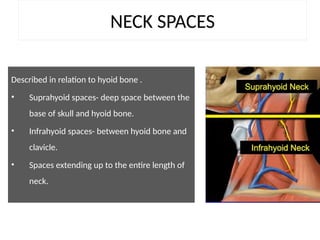 Radiological Anatomy of Neck Spaces with their clinical significance | PPTX