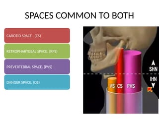 Radiological Anatomy of Neck Spaces with their clinical significance | PPTX