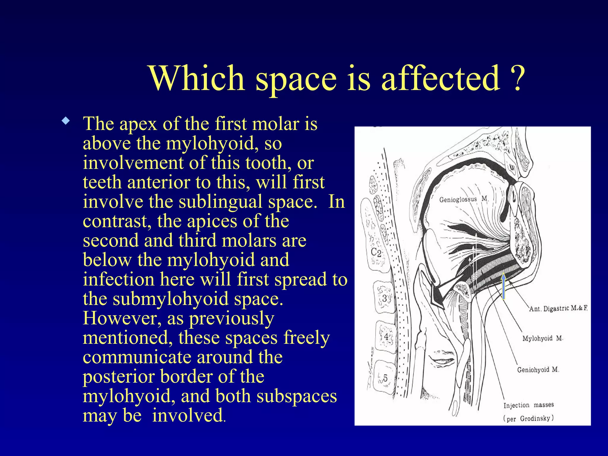 Neck spaces anatomy and infections | PPT