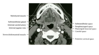 Deep neck spaces and muscles of neck- Radiology | PPTX