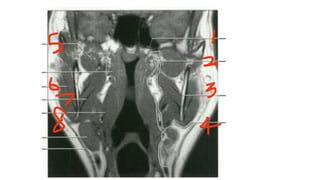 Deep neck spaces and muscles of neck- Radiology | PPTX
