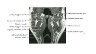 Deep neck spaces and muscles of neck- Radiology | PPTX