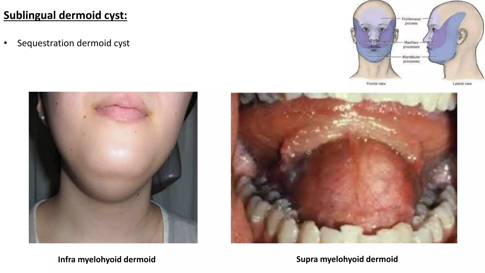 Neck Swellings Pptx