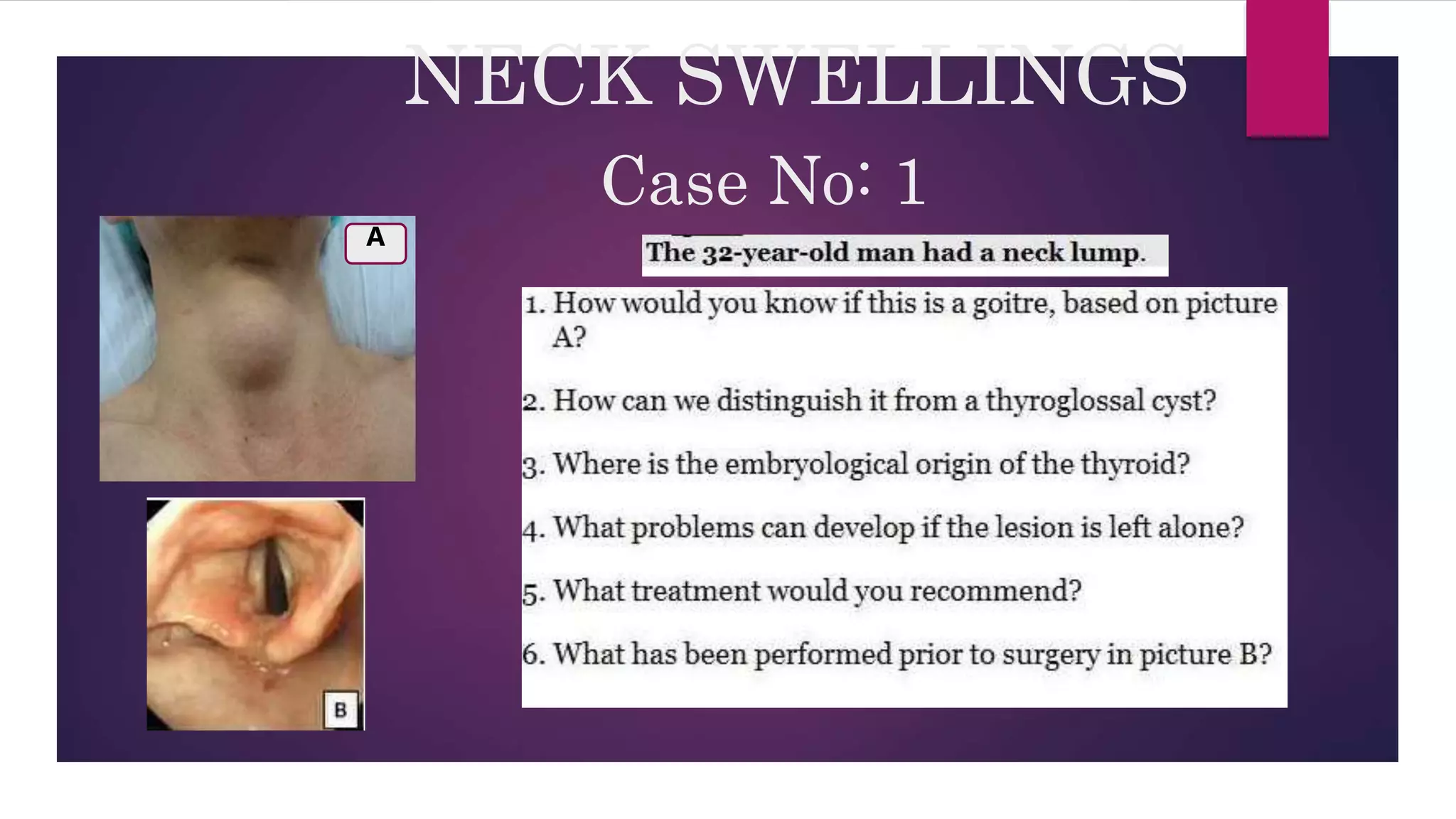 Goitre- Thyroid Swellings- Problem Based Learning/ Clinical case ...