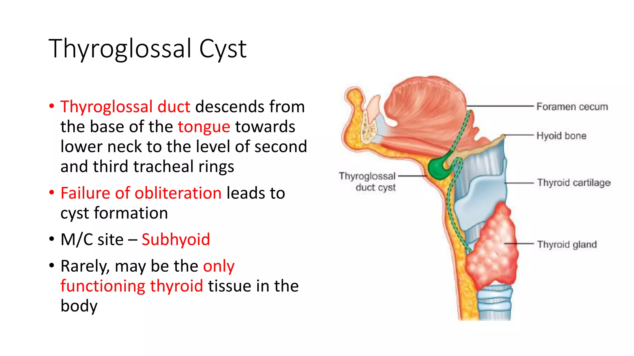 Neck swellings complete | PDF | Thyroid Disorders | Endocrine and Metabolic Diseases