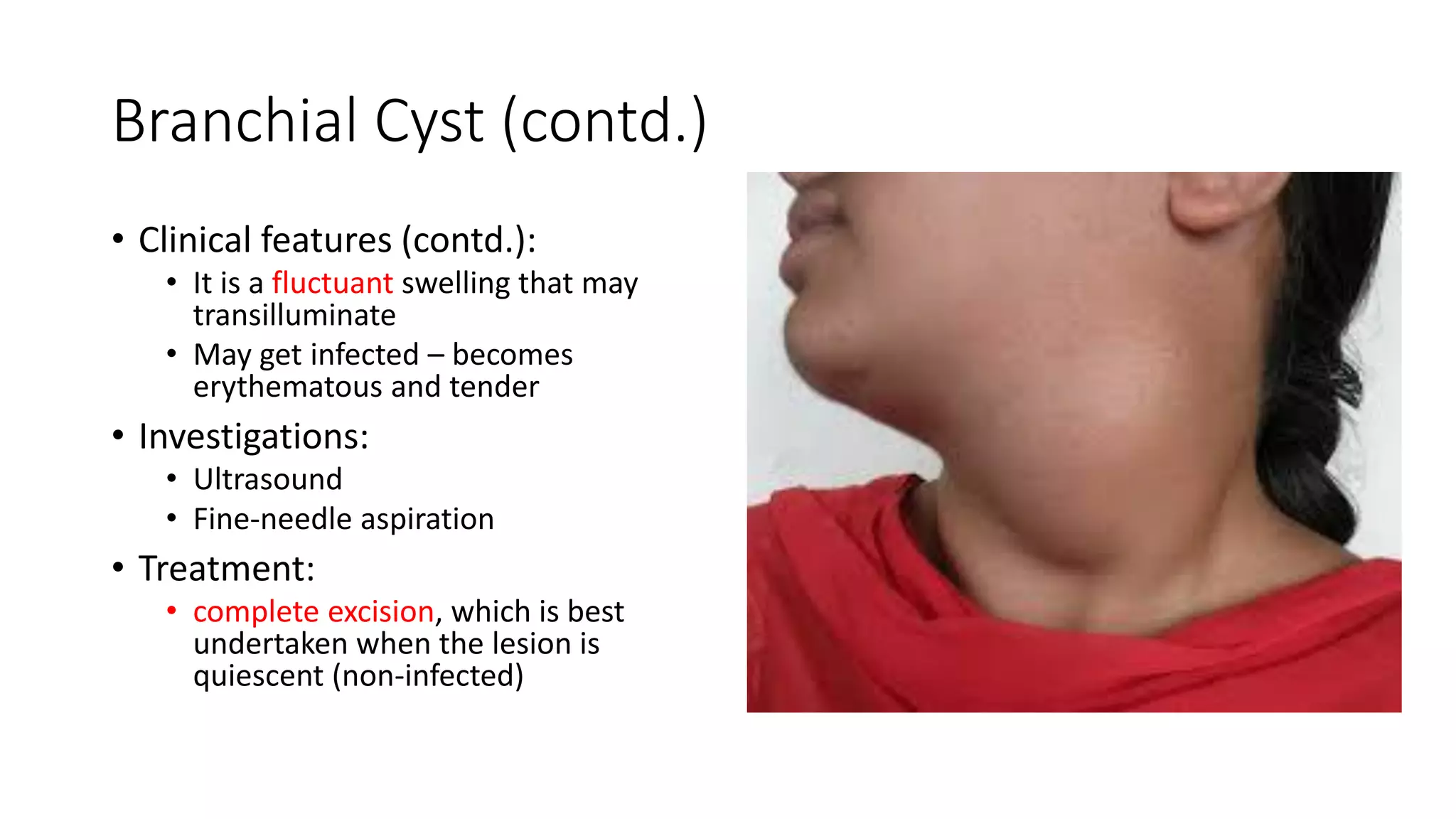 Neck swellings complete | PDF