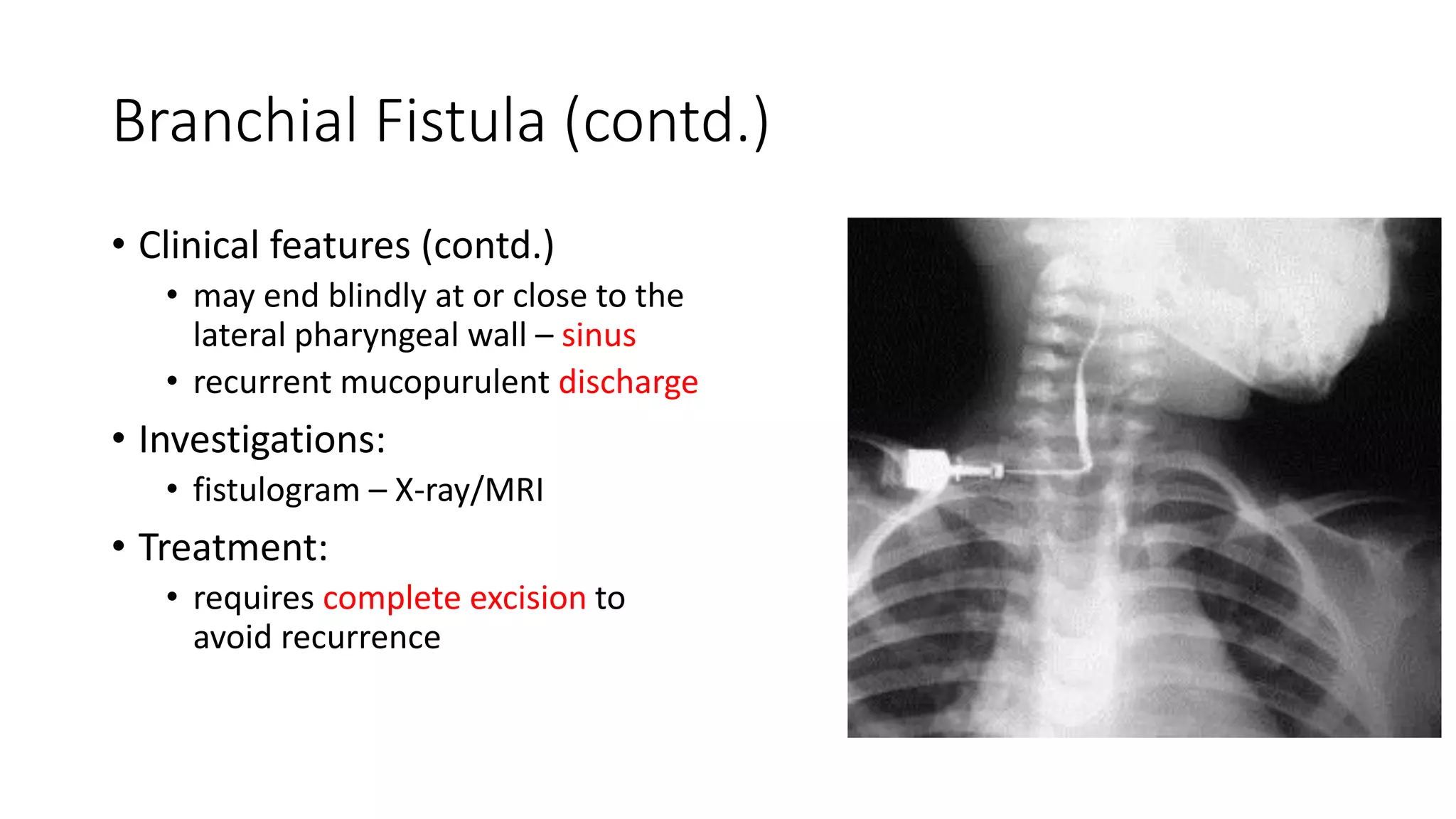 Neck swellings complete | PDF