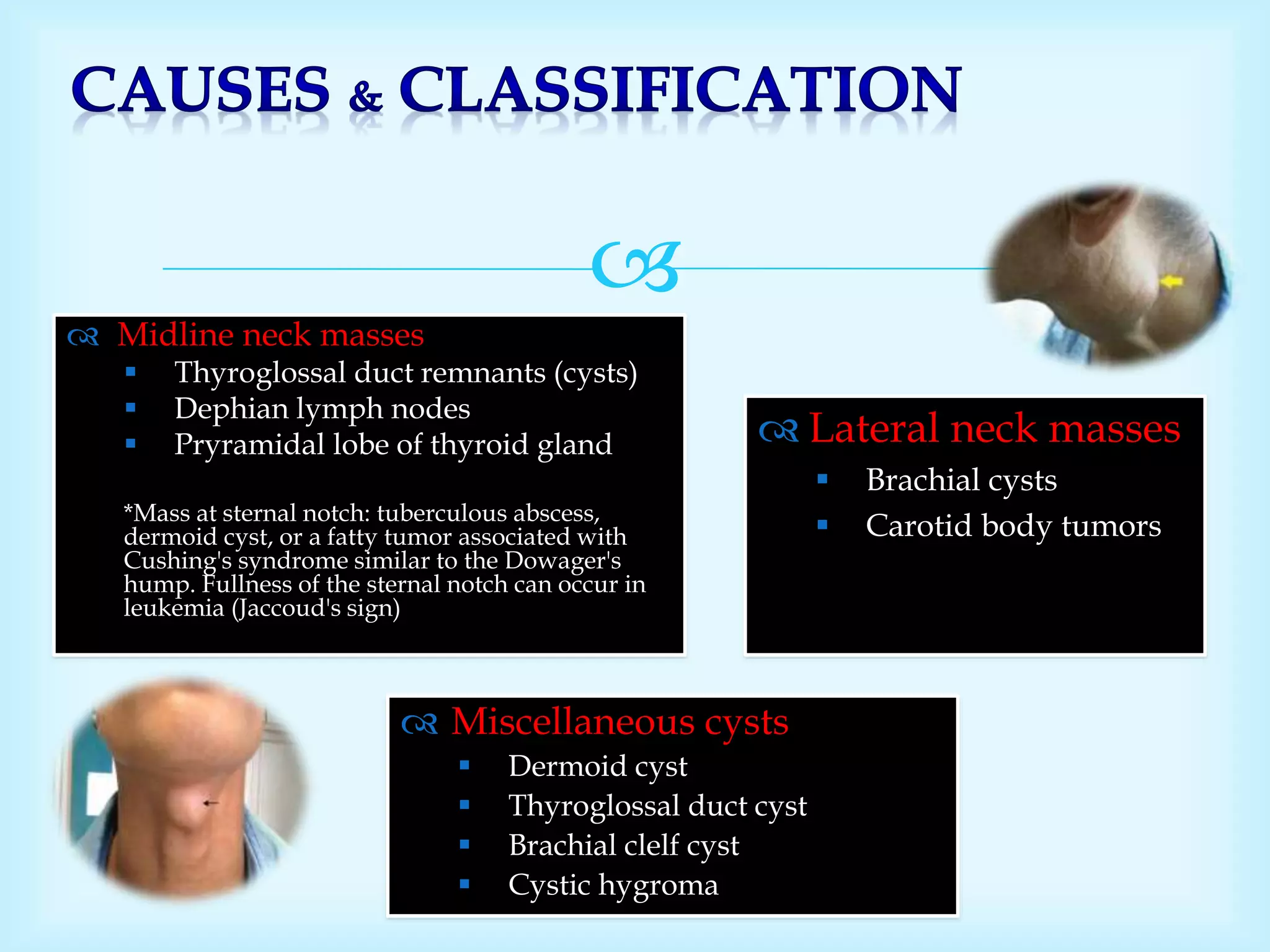 Neck swelling - History taking, Causes, Classification | PPTX