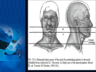 Neck trauma | PPTX