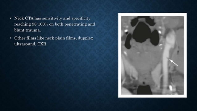 Neck trauma | PPT