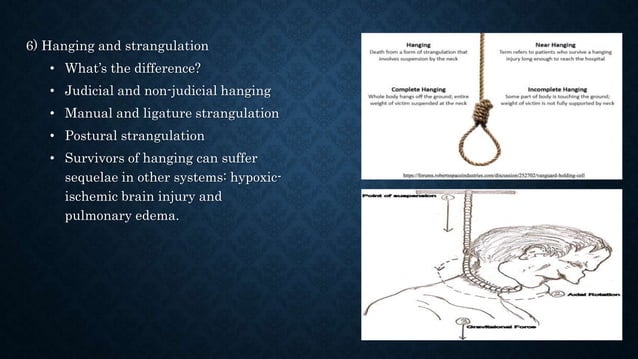 Neck trauma | PPT